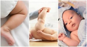 Brotoeja em Bebê – O que é, Principais Causas, Sintomas & Tratamento